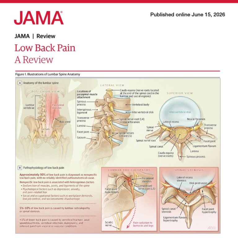 JAMA Review: Conservative Care for Low Back Pain - June 2026